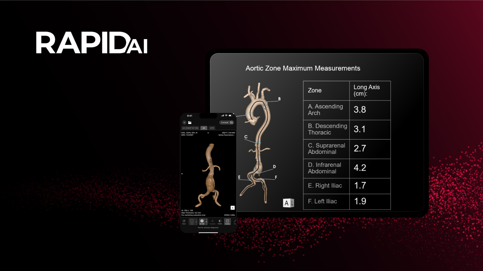 Aortic Solutions | AI-driven advanced imaging | RapidAI